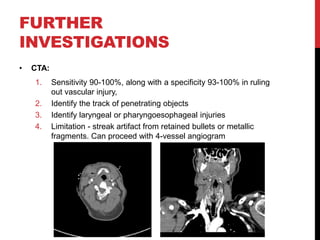 Neck trauma final.pptx