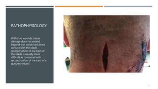 NECK TRAUMA | PPTX