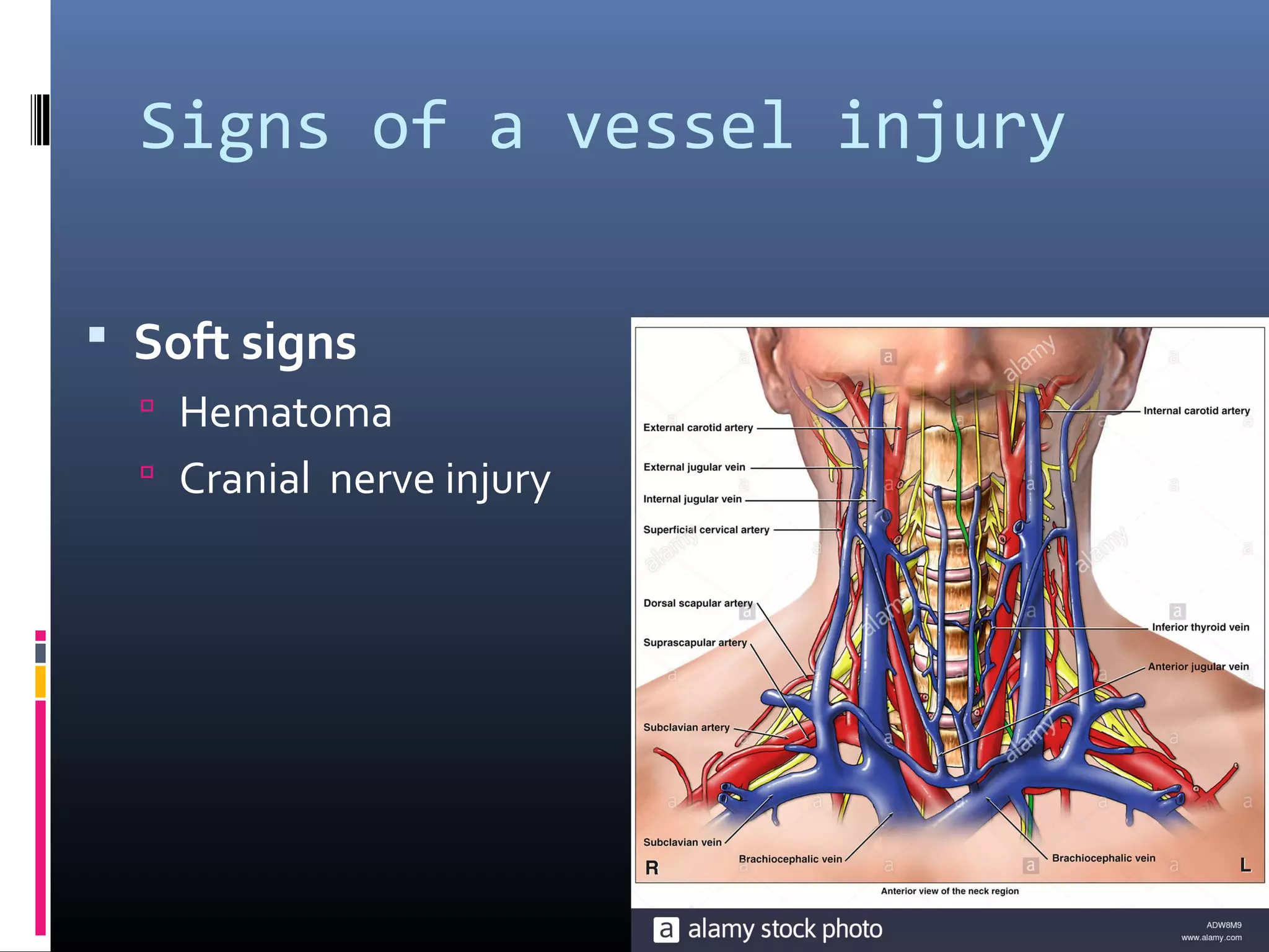 VASCULAR INJURIES OF THE NECK PRE CONGRESS WORKSHOP ACS JOEL ...