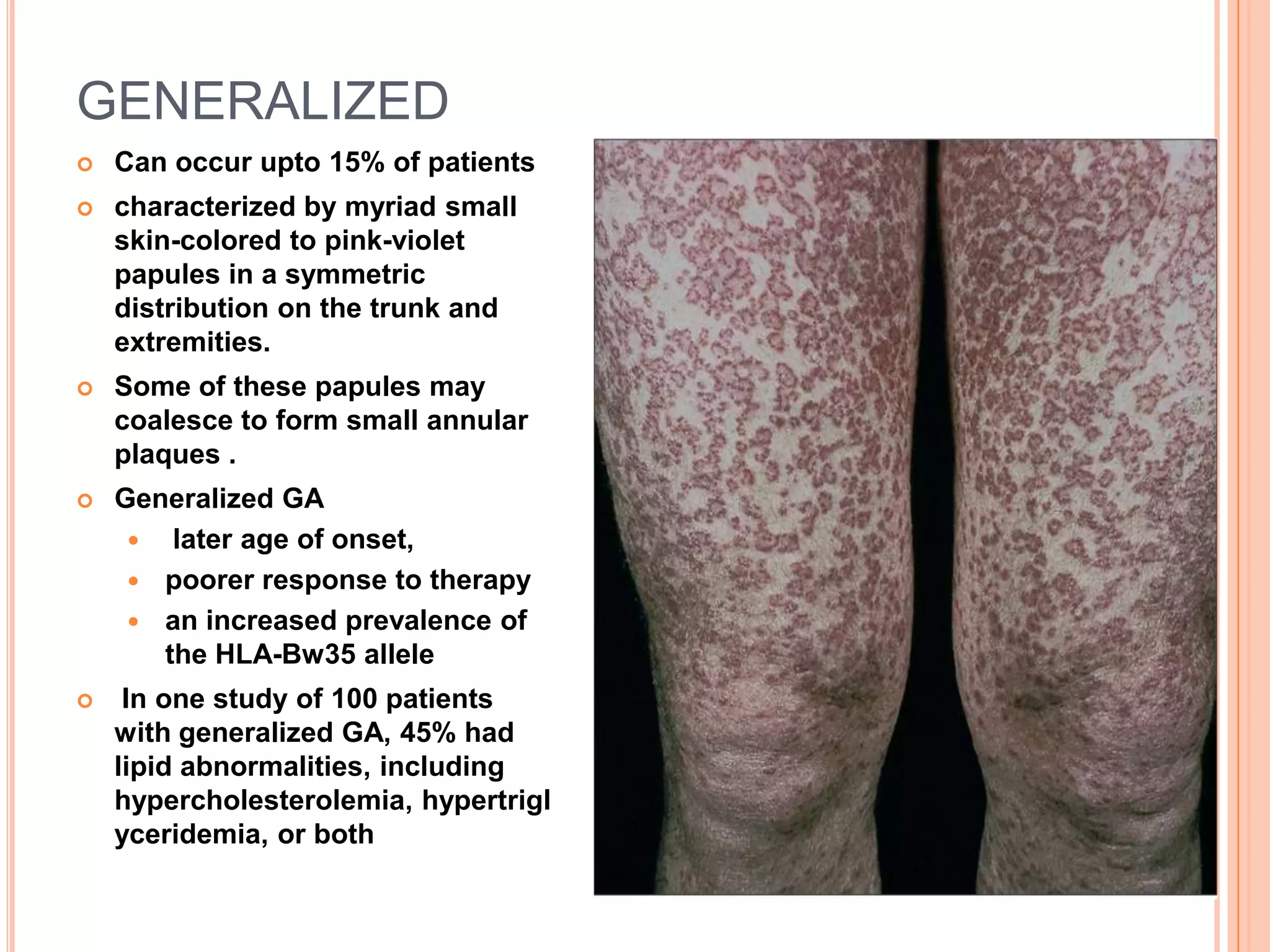 Necrobiotic disorders | PPTX