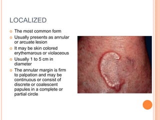 Necrobiotic disorders | PPTX