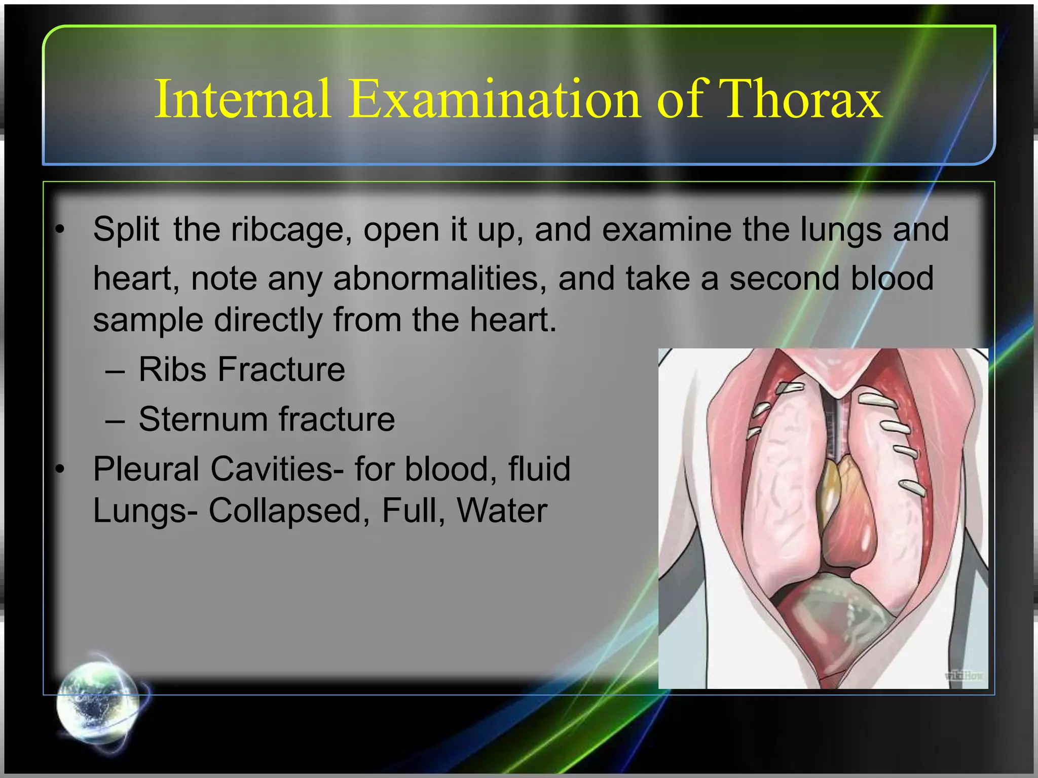 autopsy,Necropsy,postmortem | PPTX