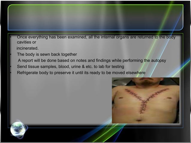 Autopsy Vs. Necropsy — What’S The Difference? – FUISMA