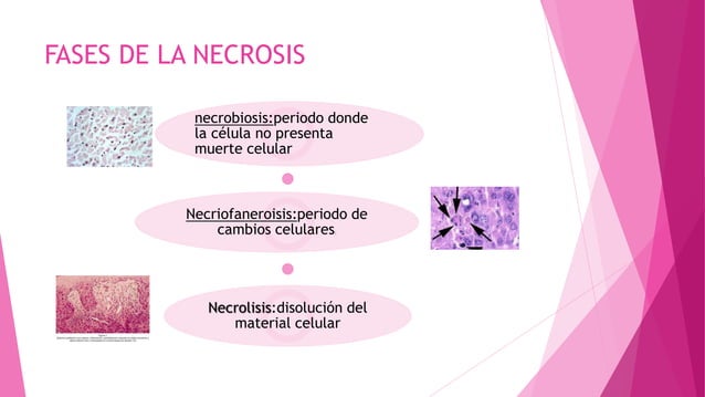 Necrosis | PPTX