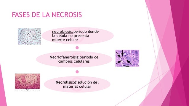Necrosis