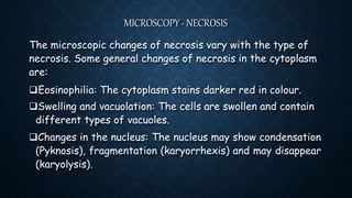 necrosis-160906190127.pptx