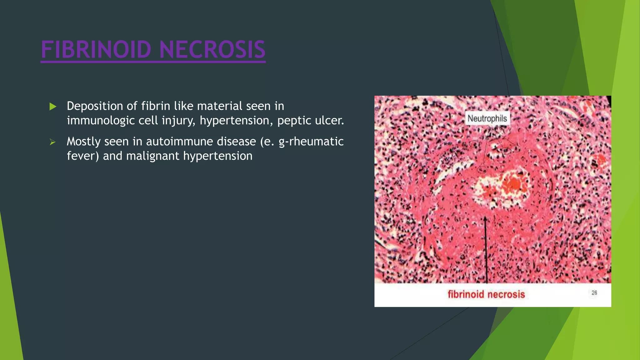 Necrosis | PPTX | Blood Disorders | Diseases and Conditions