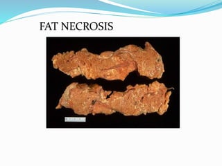 Necrosis | PPT