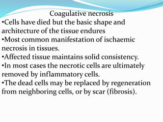 Necrosis | PPT