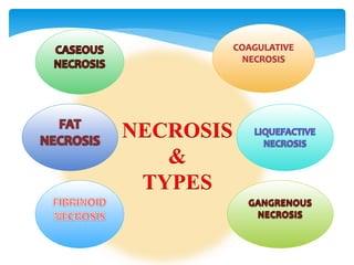 Necrosis and types | PPTX