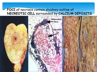 Necrosis and types | PPTX