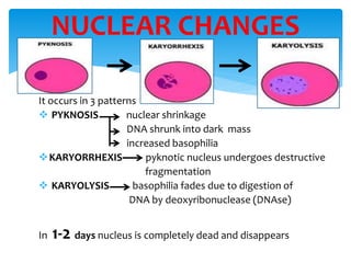 Necrosis and types | PPTX