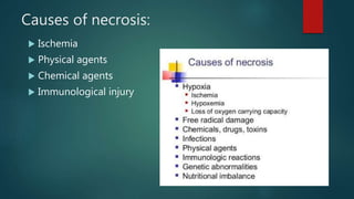 Necrosis | PPTX