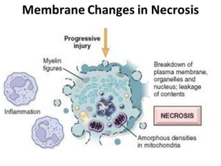 Necrosis | PPT