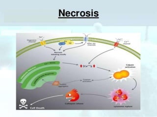 Necrosis | PPT