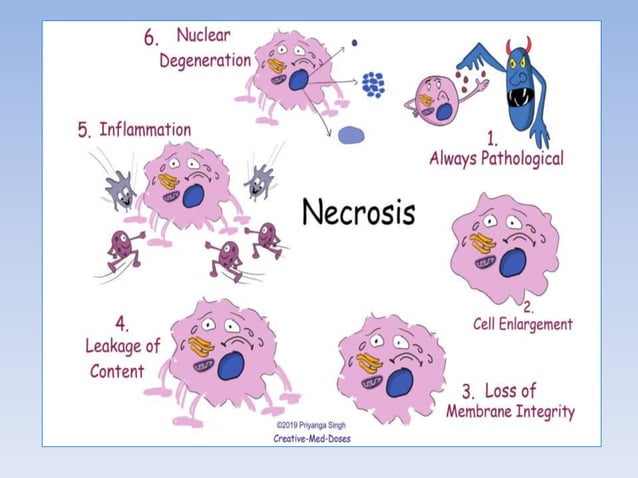 Necrosis | PPTX | Blood Disorders | Diseases and Conditions
