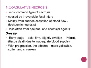 Necrosis | PPTX