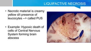 NECROSIS FOR MBBS FIRST YEAR STUDENTS MADE EASY.pptx
