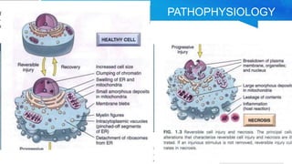NECROSIS FOR MBBS FIRST YEAR STUDENTS MADE EASY.pptx