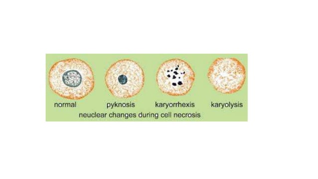 Necrosis.pptx definition, types, examples | PPTX | Blood Disorders ...