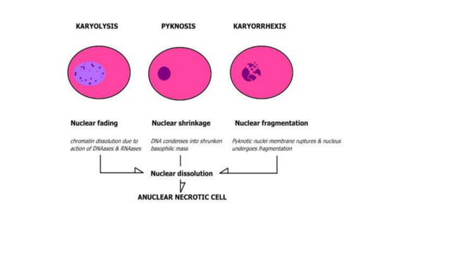 Necrosis.pptx definition, types, examples | PPTX | Blood Disorders ...