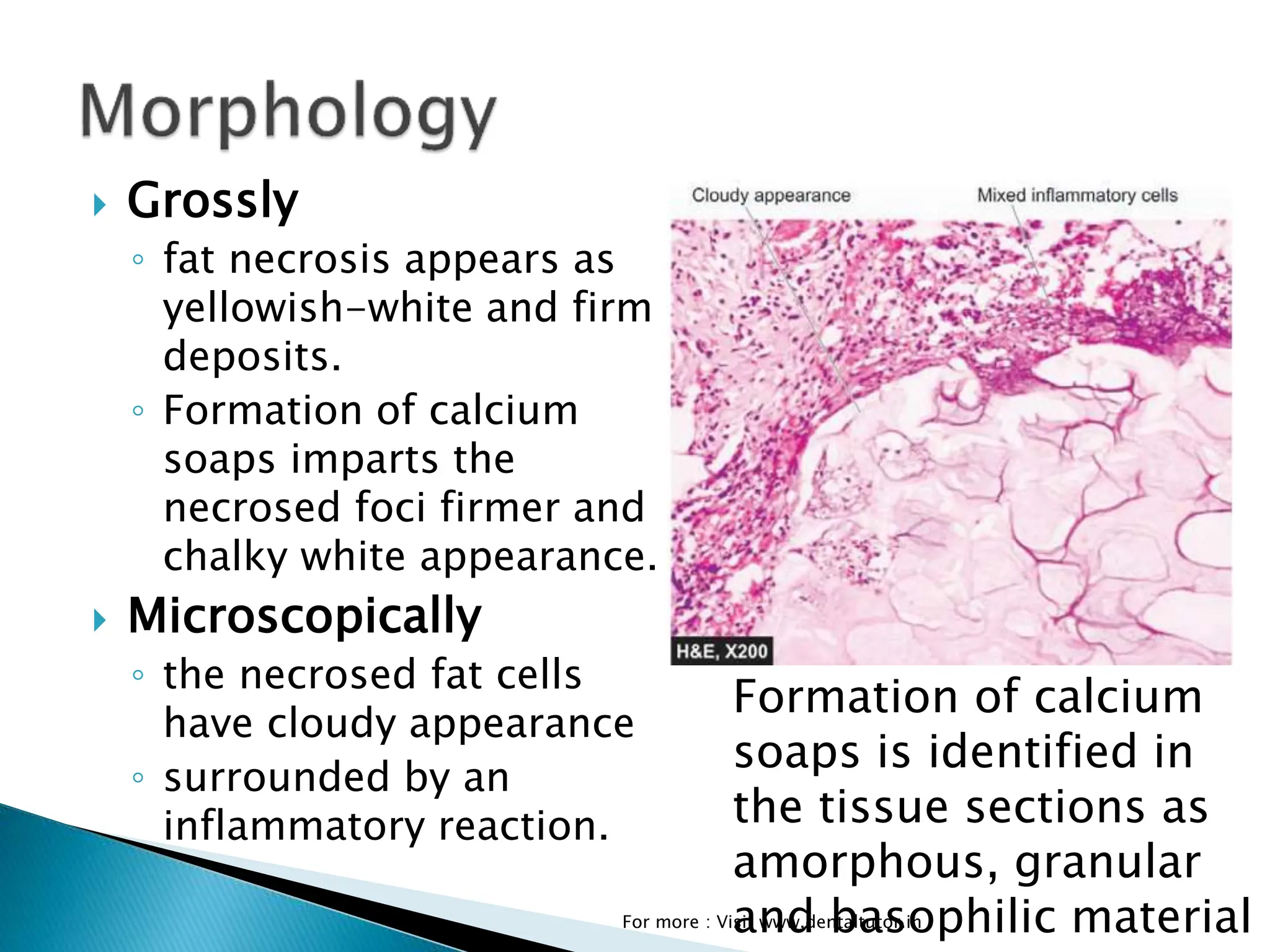 necrosis pathology by talha shahid .pptx