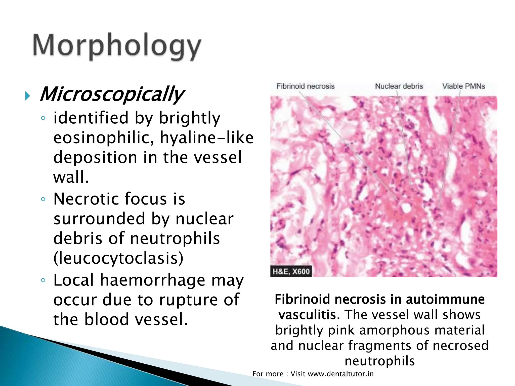 necrosis pathology by talha shahid .pptx