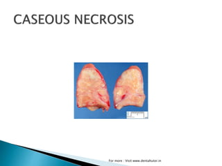 necrosis pathology by talha shahid .pptx