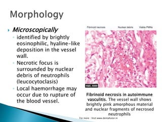 necrosis pathology by talha shahid .pptx