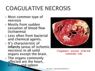 necrosis pathology by talha shahid .pptx | Biological Sciences | Science