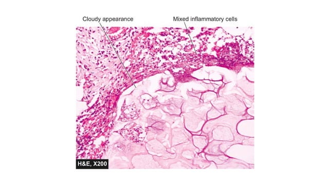 MORPHOLOGY OF CELL INJURY - NECROSIS.pptx
