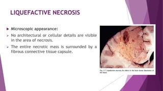 Necrosis (1) | PPTX