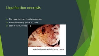 Necrosis and apoptosis | PPTX