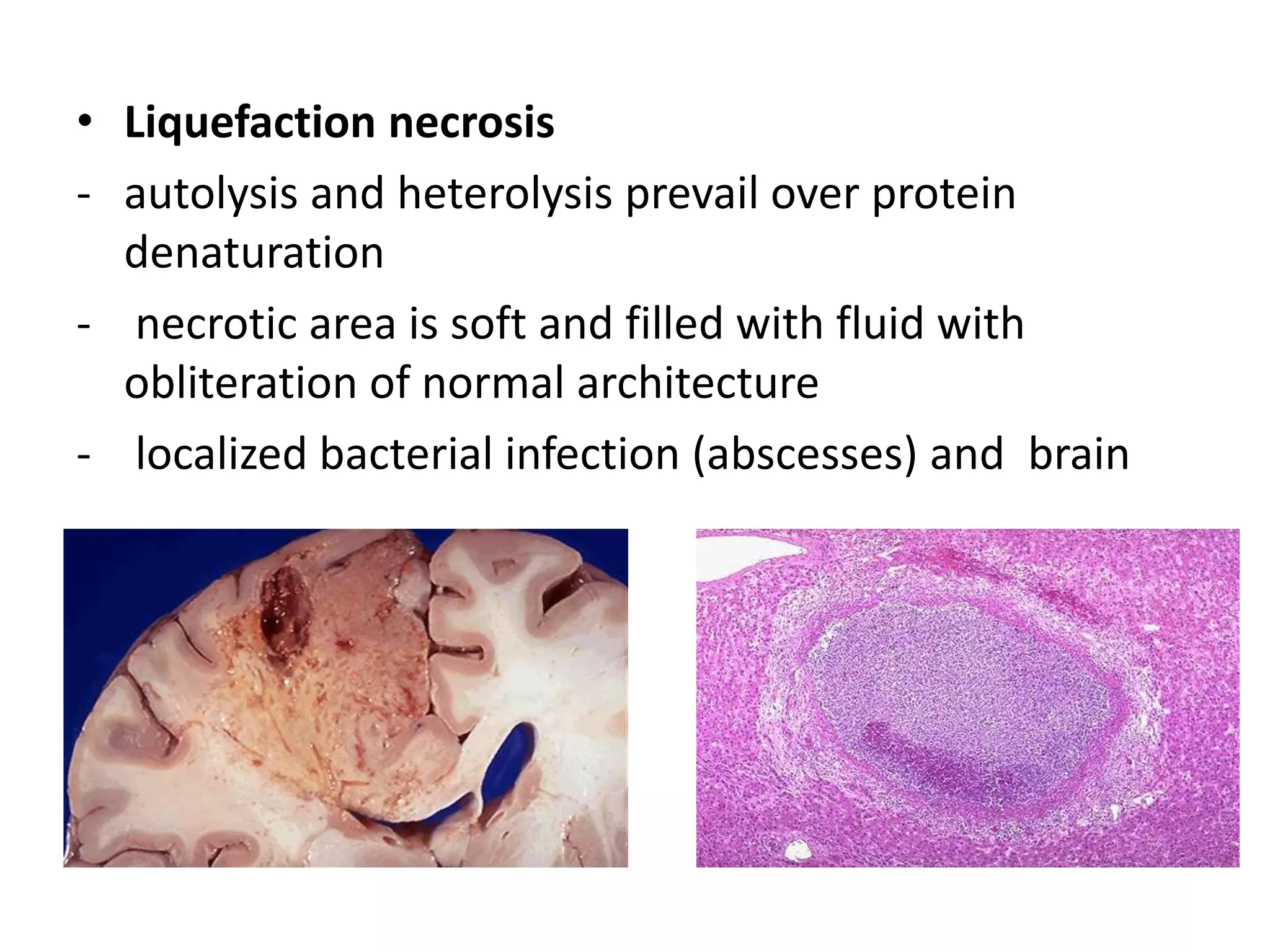Necrosis and apoptosis | PPTX