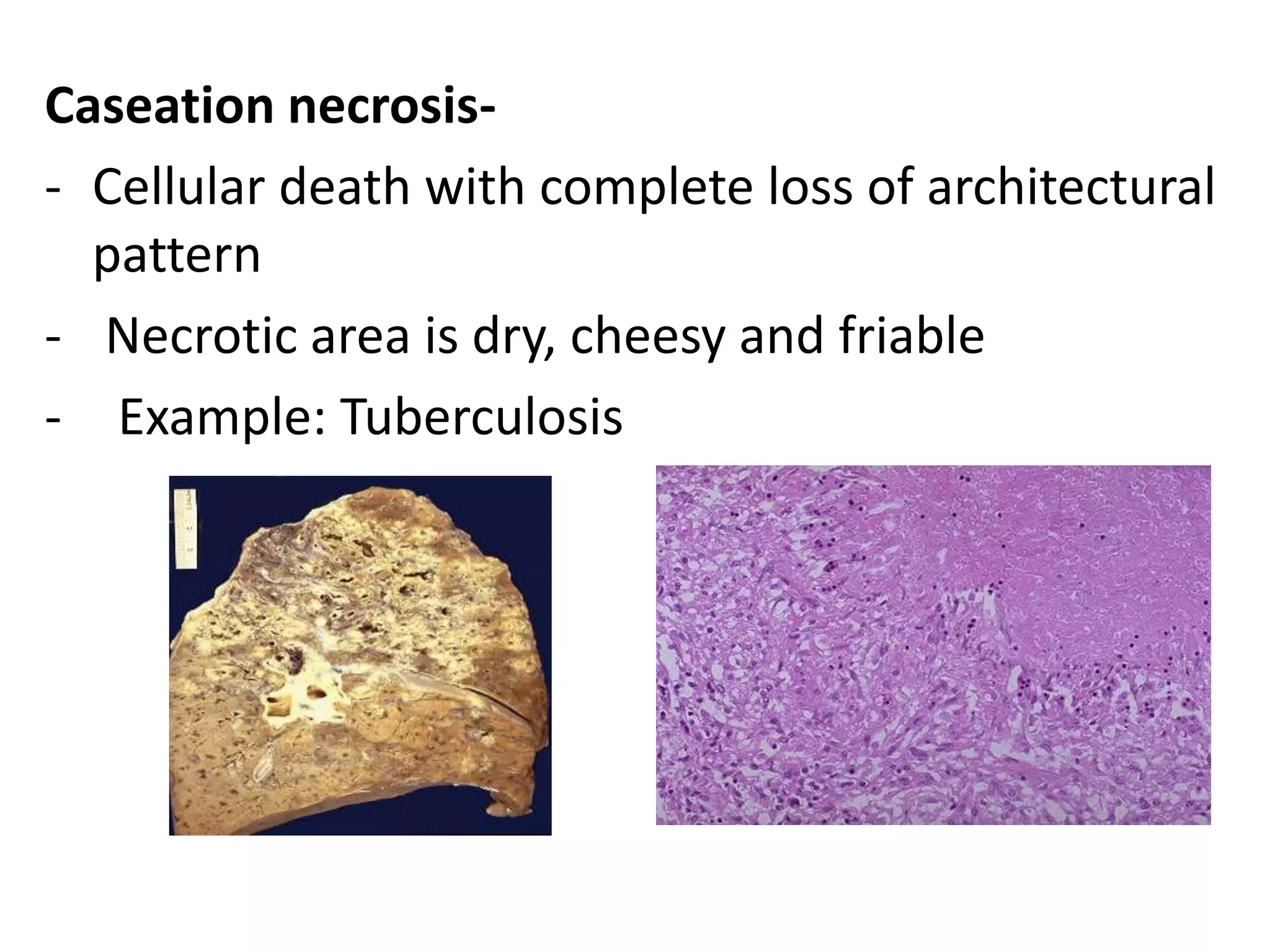 Necrosis and apoptosis | PPTX