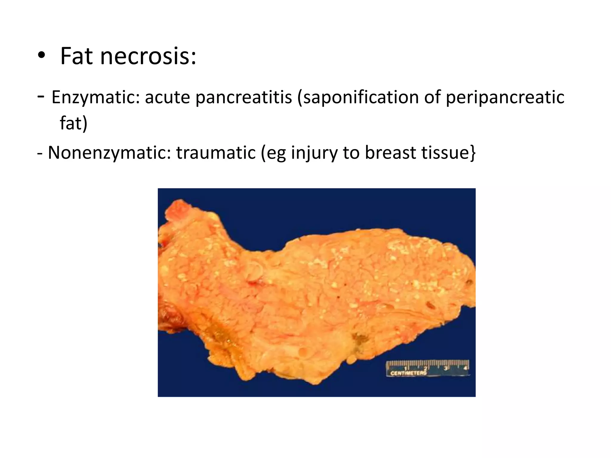 Necrosis and apoptosis | PPTX