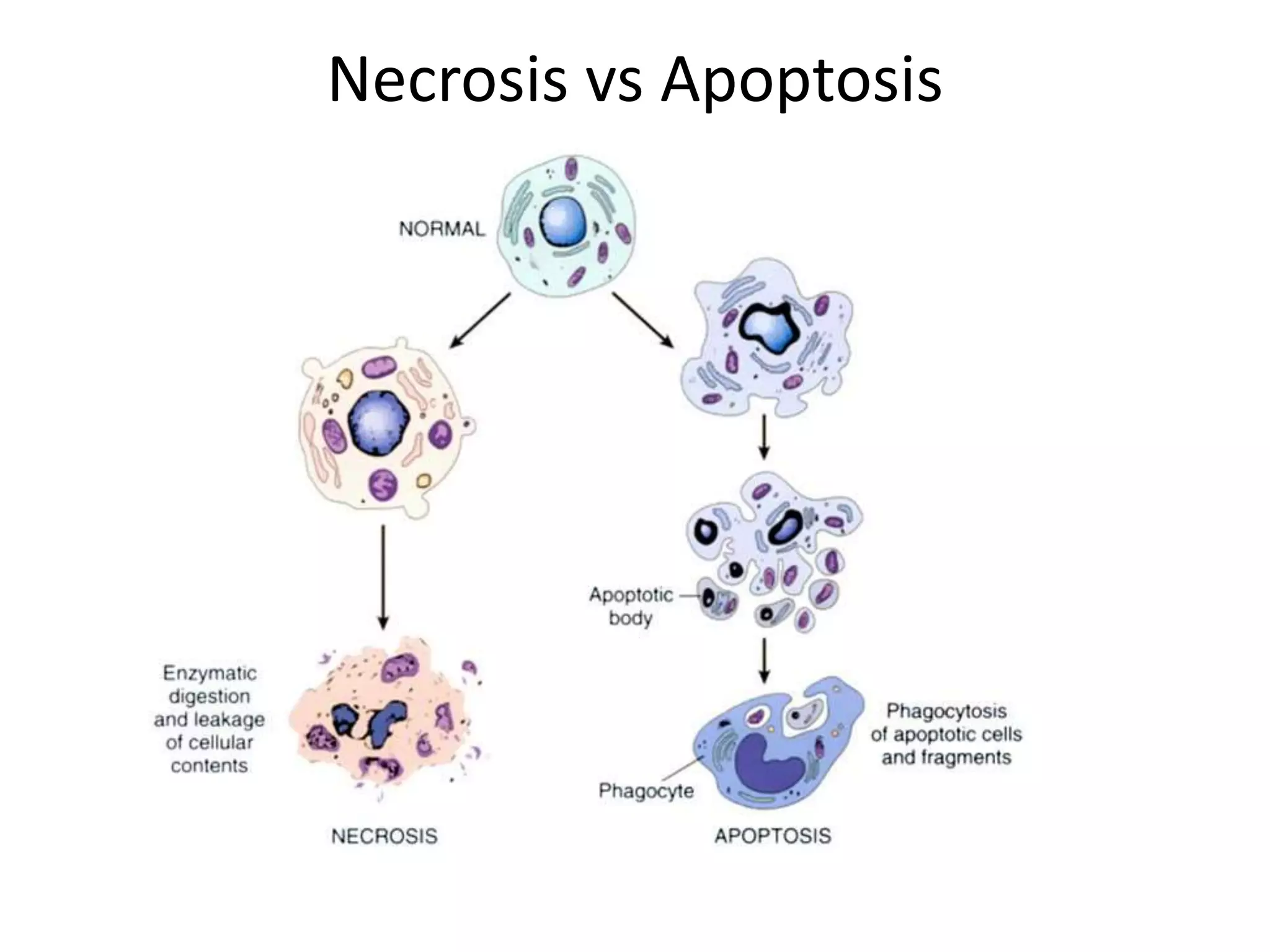 Necrosis and apoptosis | PPTX