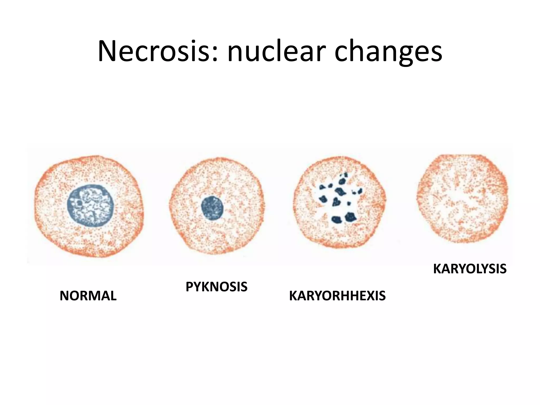 Necrosis and apoptosis | PPTX