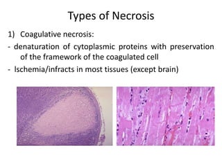 Necrosis and apoptosis | PPTX