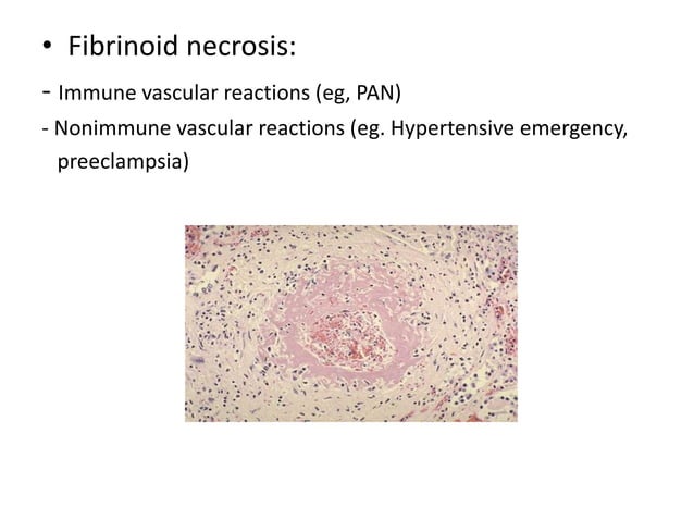 Necrosis and apoptosis | PPTX