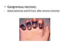 Necrosis and apoptosis | PPTX