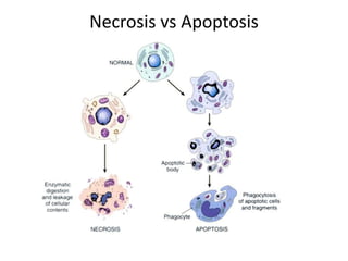 Necrosis and apoptosis | PPTX