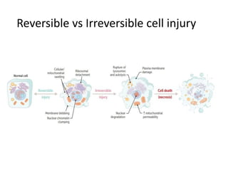 Necrosis and apoptosis | PPTX