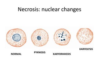 Necrosis and apoptosis | PPTX