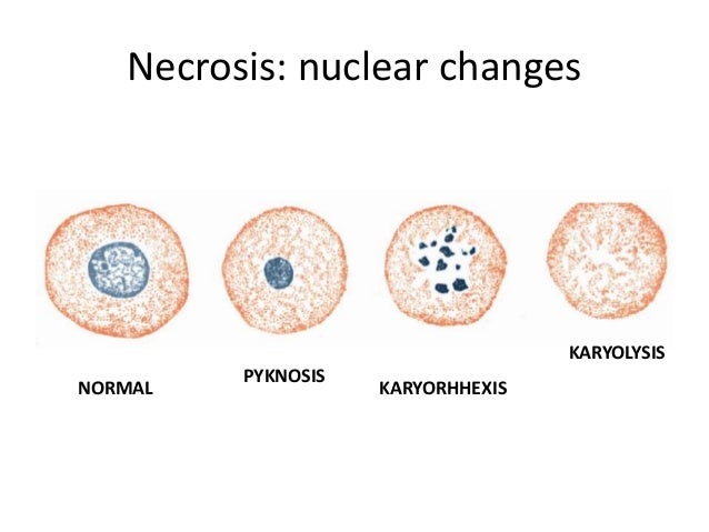 Necrosis and apoptosis