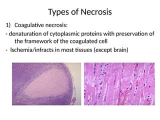 necrosis and apoptosis about cell death.pptx