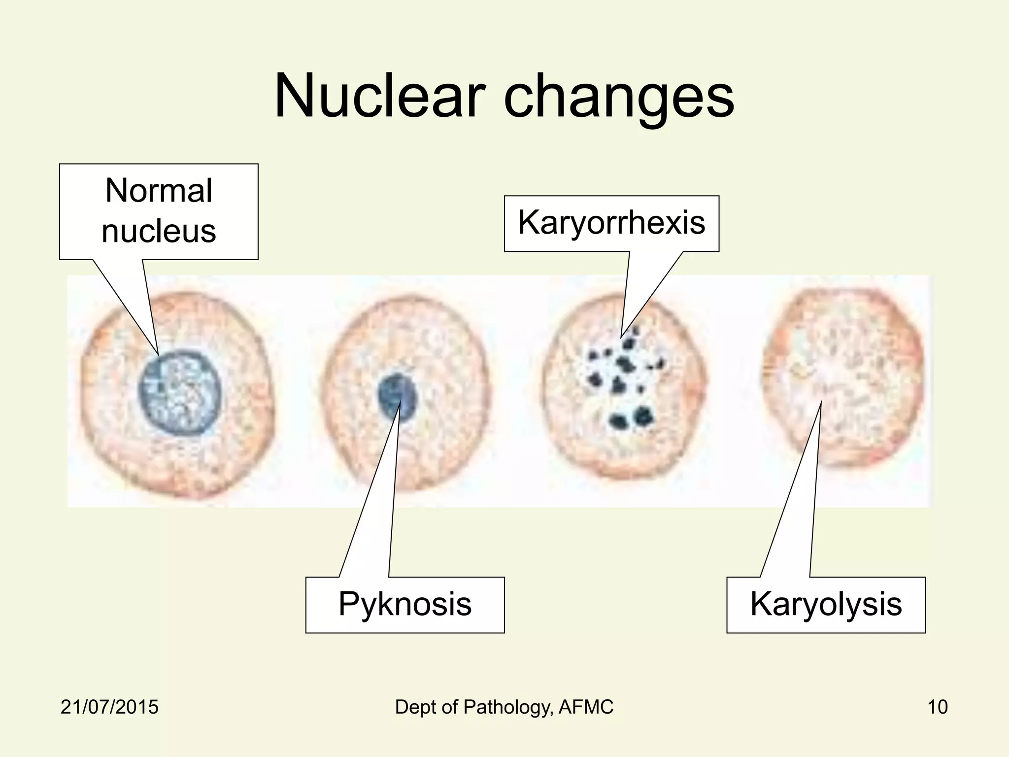 Necrosis and gangrene | PPT