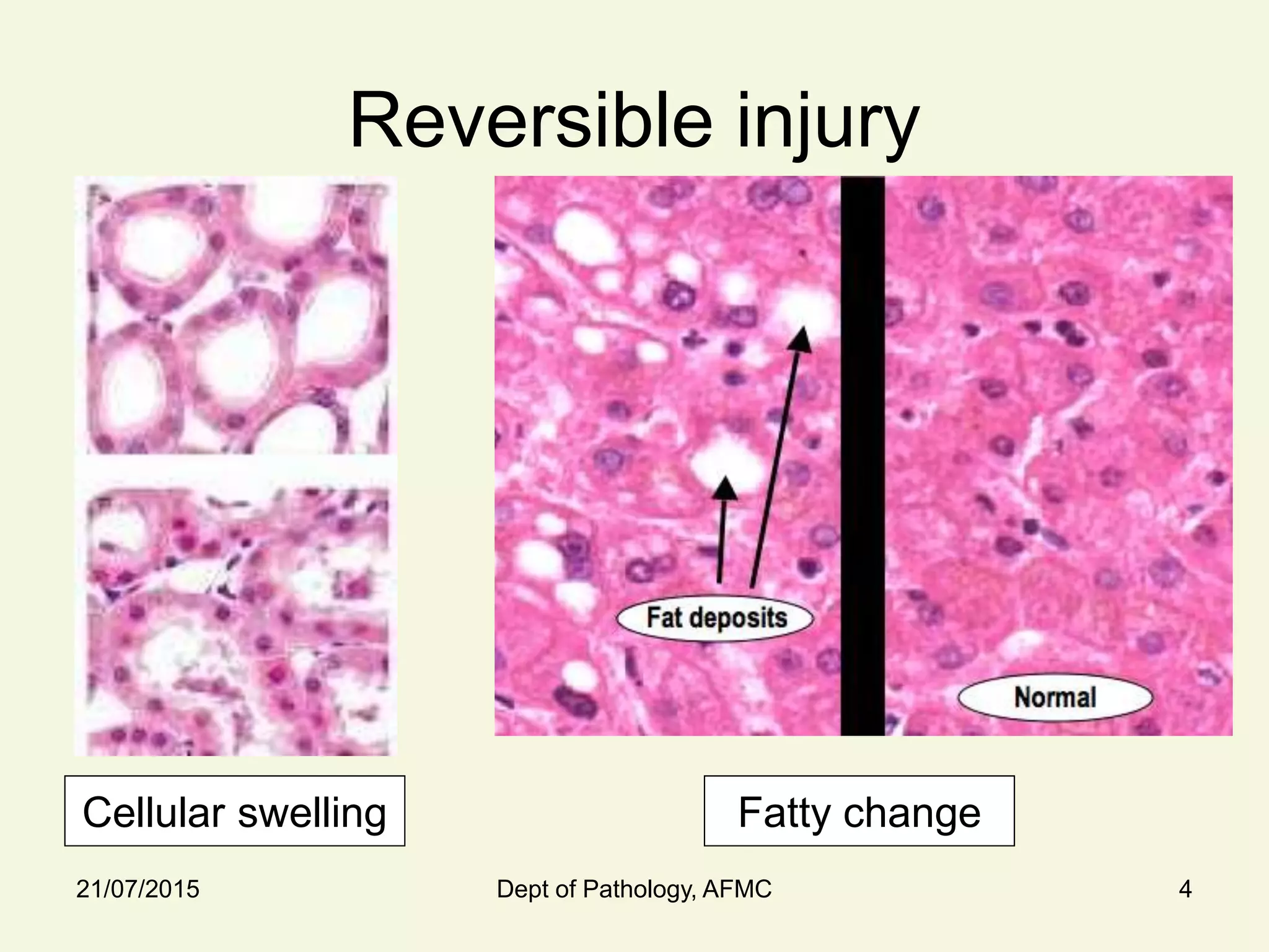 Necrosis and gangrene | PPT