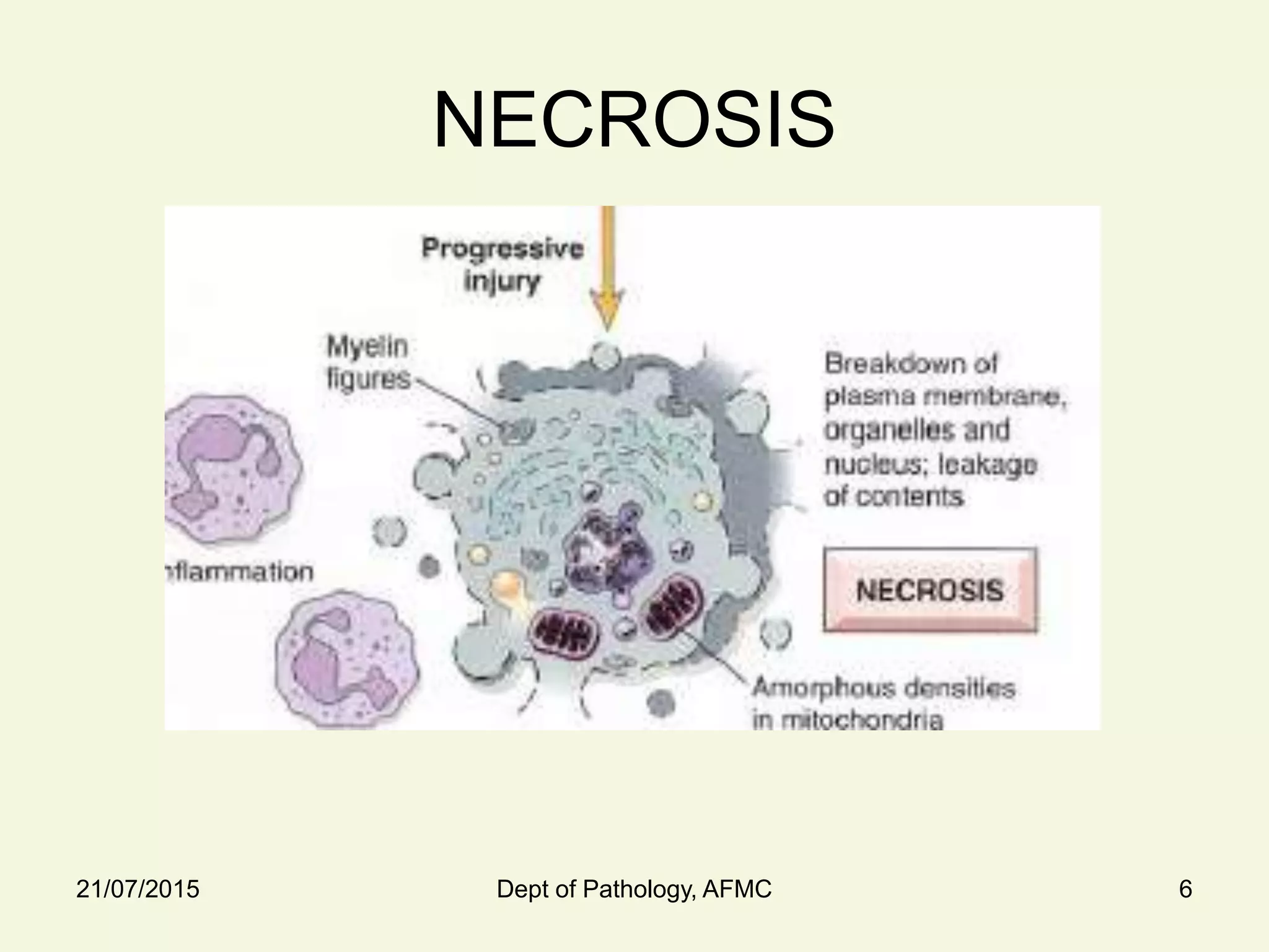 Necrosis and gangrene | PPT