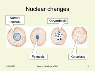 Necrosis and gangrene | PPT